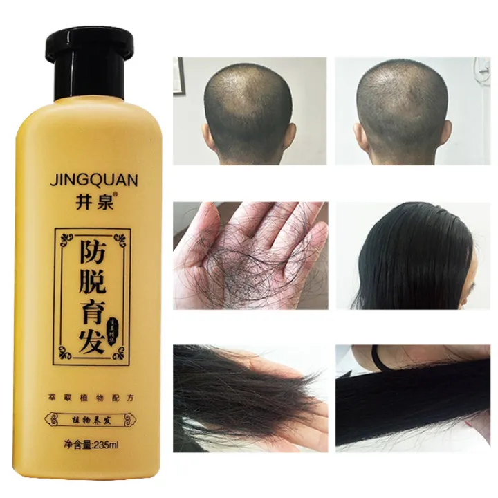 Shampoo Prevent Hair Loss Nourish Anti-Dandruff Antipruritic Refresh Oil Control Ginger Hair ...