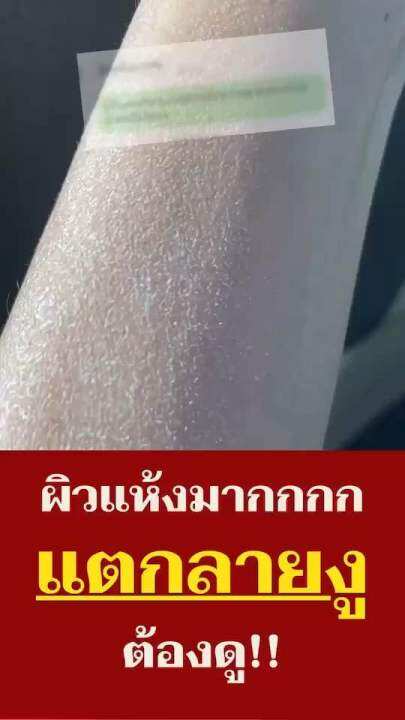 Rabye :X3 Milk Brightน้ำนมข้าวสกัดเย็น ลดขนคุด ผิวอักเสบ รอยแตกลาย ...