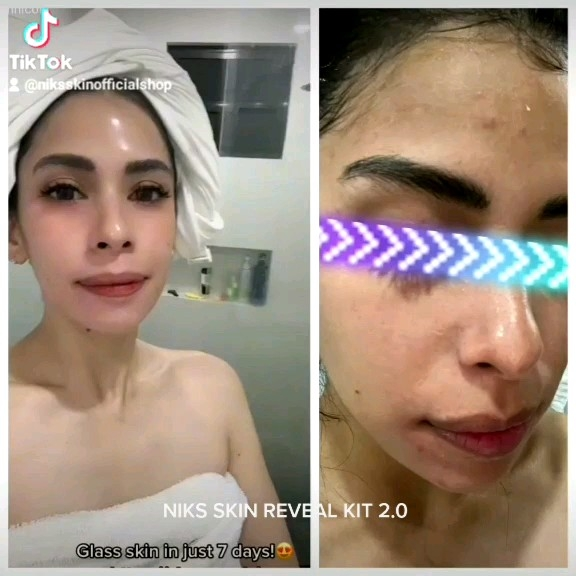 NIKS SKIN REVEAL KIT (REJUV SET) | Lazada PH