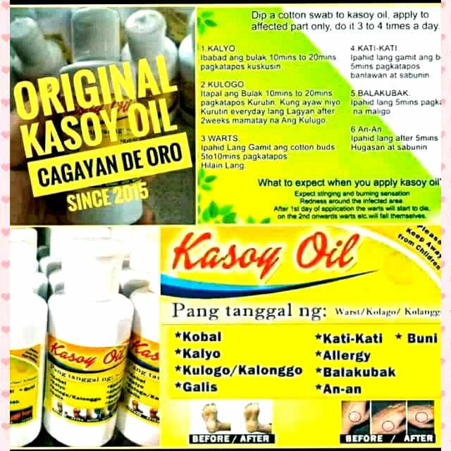 ORIGINAL Warts removal Kasoy Oil Organic( 30ml ) Pantanggal ng Kulugo ...