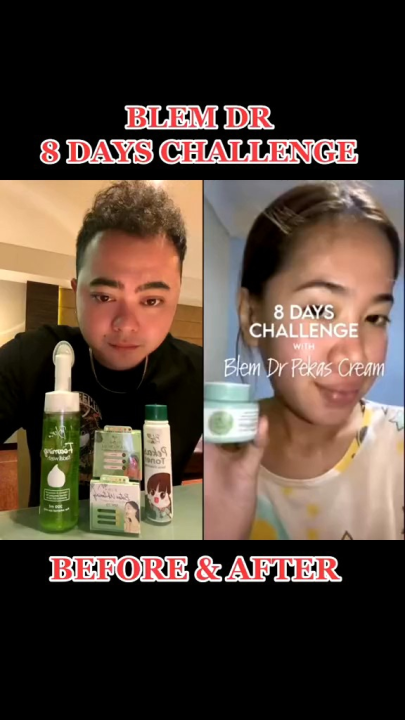 BLEM DR THE ULTIMATE PEKAS AND MELASMA CREAM | Lazada PH
