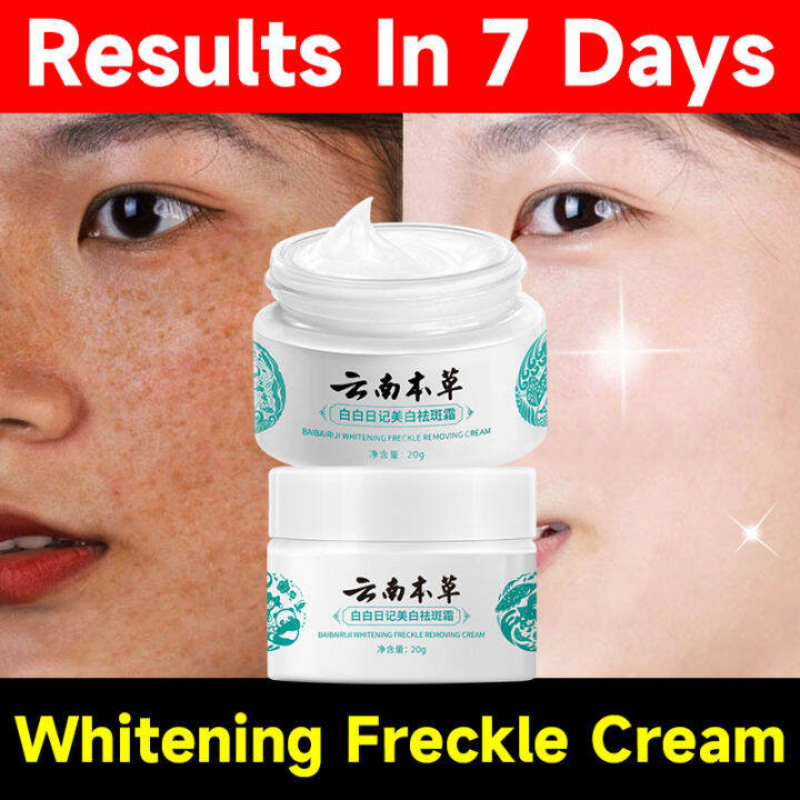 20g Japanese Melasma Cream Melasma Cream From Japan Yunnan Herbal ...