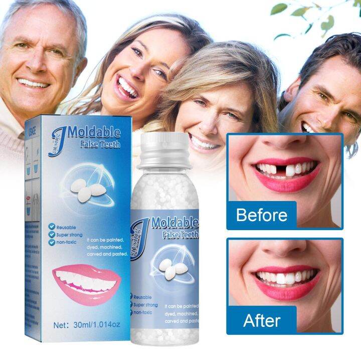teeth temporary restoration denture filling solid gel solid denture material tooth restoration ...