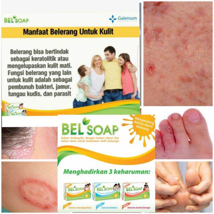 SABUN SULFUR BELERANG BELSOUP UNTUK PANU KADAS KURAP | Lazada Indonesia