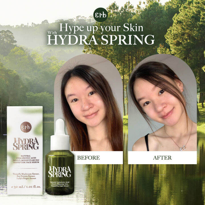 Erb Hydra-Spring Natural Hyaluronic Acid Tripeptide Face Serum - 30 ml ...