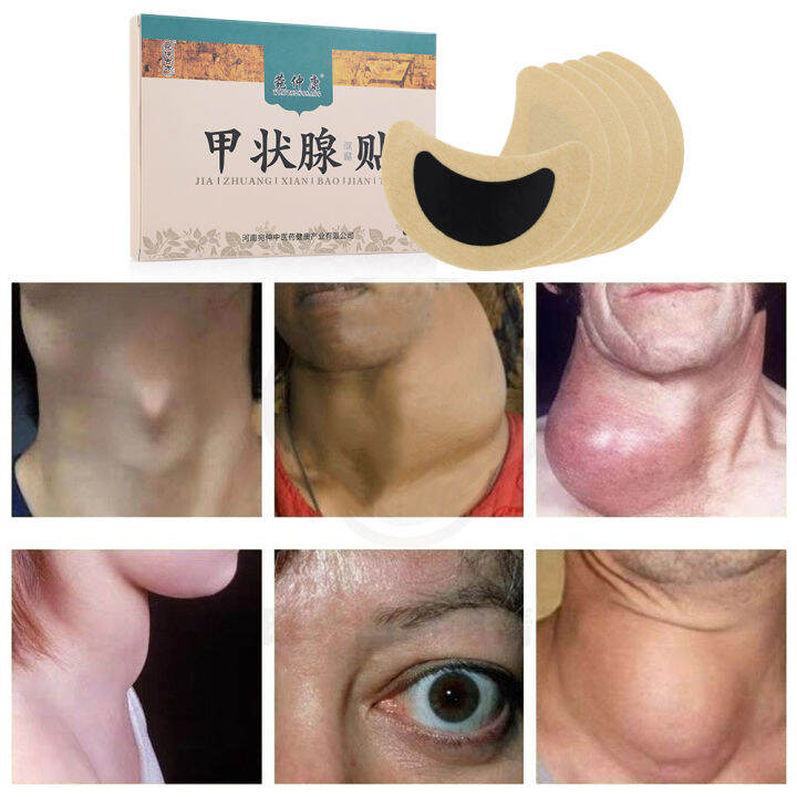 6Pcs Thyroid Health Patch Lymphatic Sticker Thyroid Nodule Patch ...