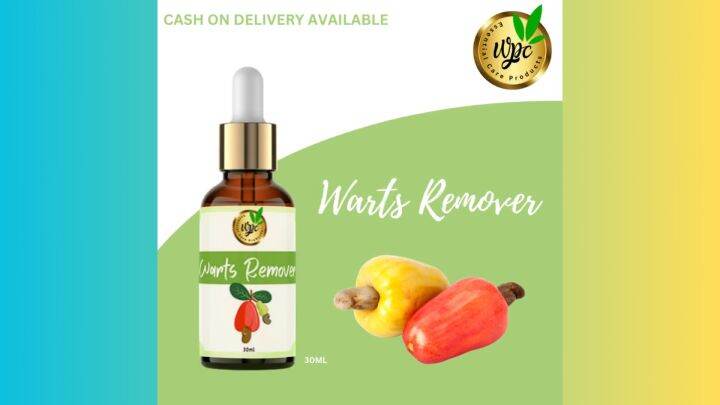 WPC Warts Remover 30ml Warts Remover Original Cream Magic Wartz Removal ...