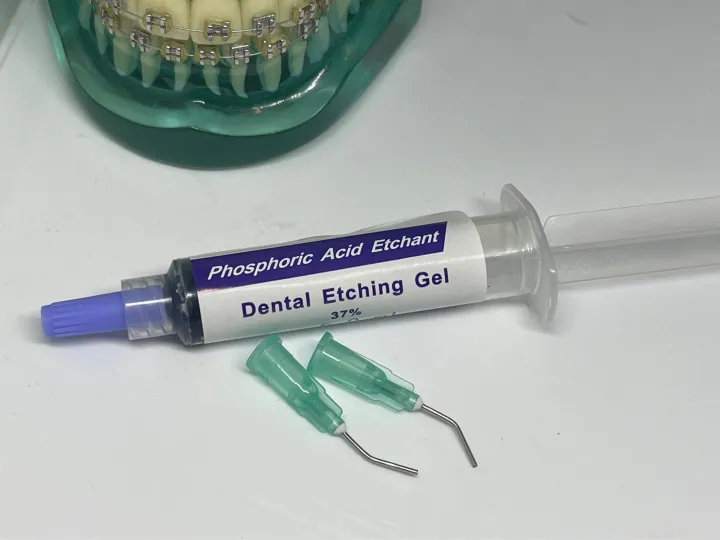 5ml etching gel | Lazada PH