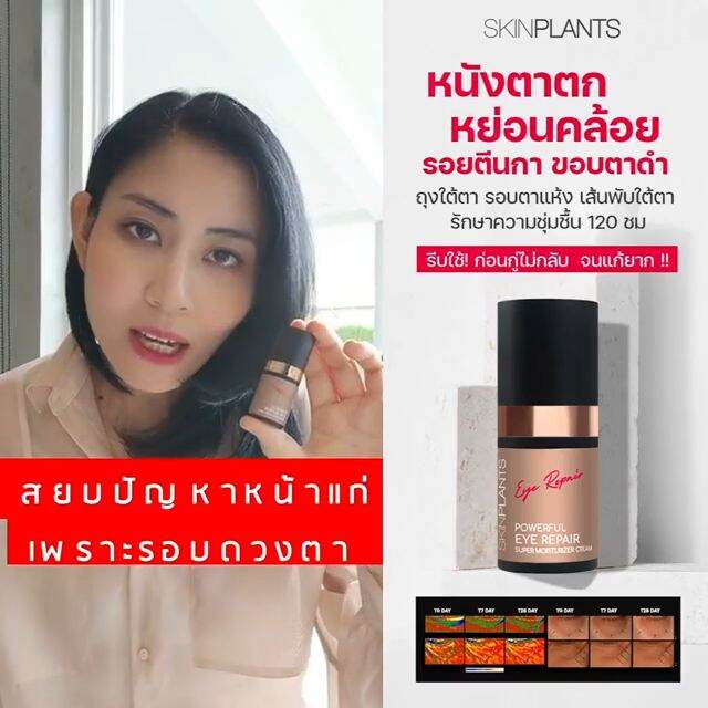 ส่งไว 🌟 SKINPLANTS เซตสุดคุ้ม Vc Gold Eye Cream อายครีม เซรั่มลดฝ้ากระ จุดด่างดำ ลดเลือนริ้วรอย ...