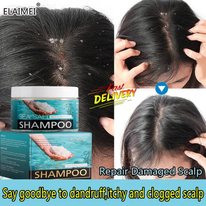 【7 Days 100% Effective】ELAIMEI Sea Salt Anti Dandruff Shampoo For ...