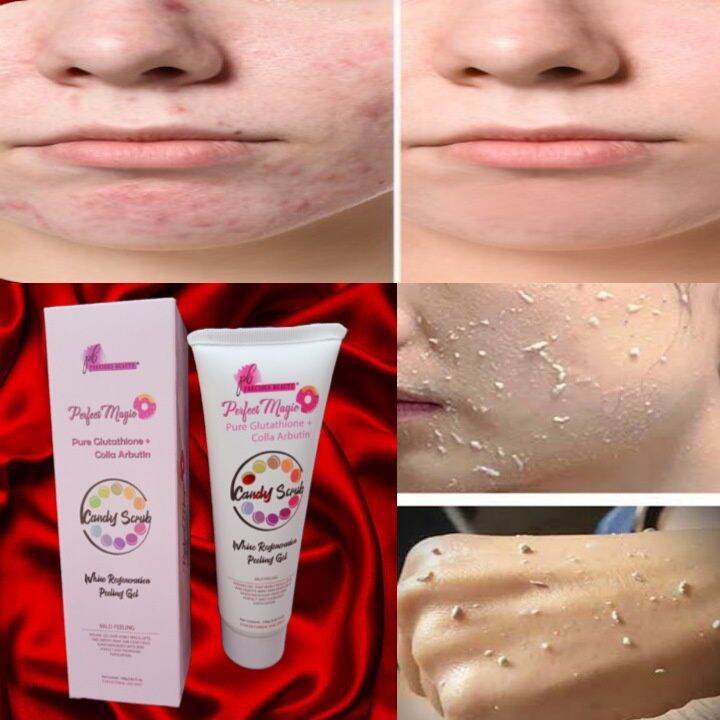 Peeling Gel Candy Scrub by Precious Beauty | Lazada PH