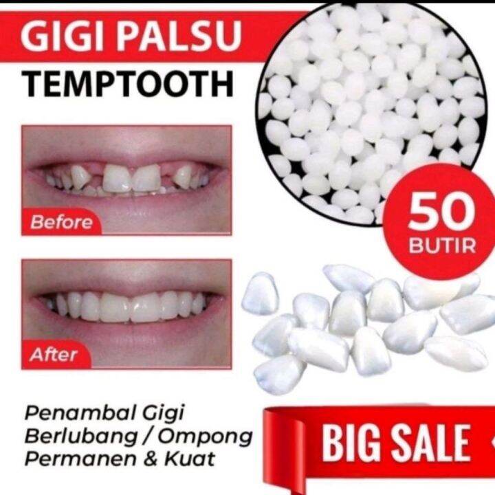 lem gigi tambal gigi gigi ompong praktis | Lazada Indonesia
