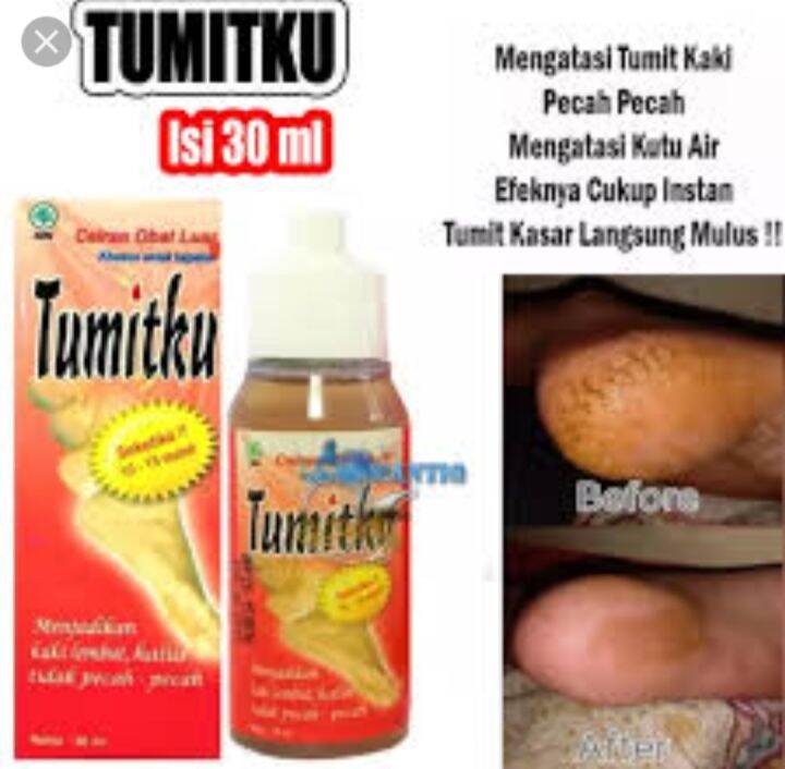 TUMITKU OBAT KAKI PECAH Original BPOM Solusi Kaki Pecah-pecah Dan ...