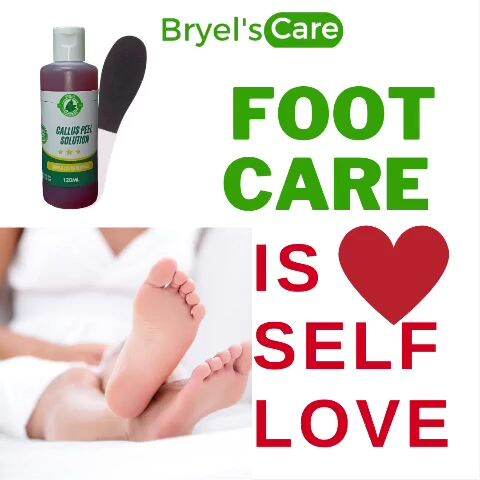 ⚡⚡Bryel's care Callus and Corn Remover peeling solution Pantanggal ng ...
