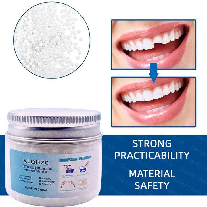 Teeth Restoration 50g Dentures veneers temporary teeth -- temporary ...
