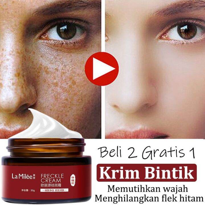 La Milee Freckle Cream 30g Meringankan Melasma Meringankan Pigmentasi ...