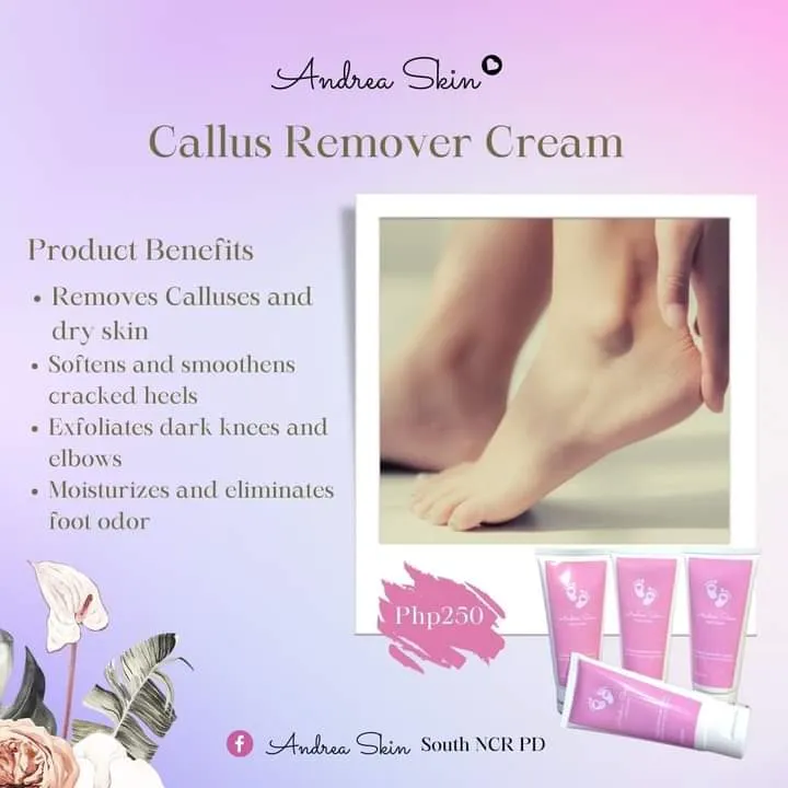 Andrea Skin Callus Removal Cream 💯% effective | Lazada PH