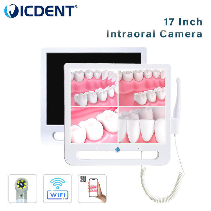 GreatLife Dent Wifi HD 8 Million Pixels High-definition Endoscope Tools ...