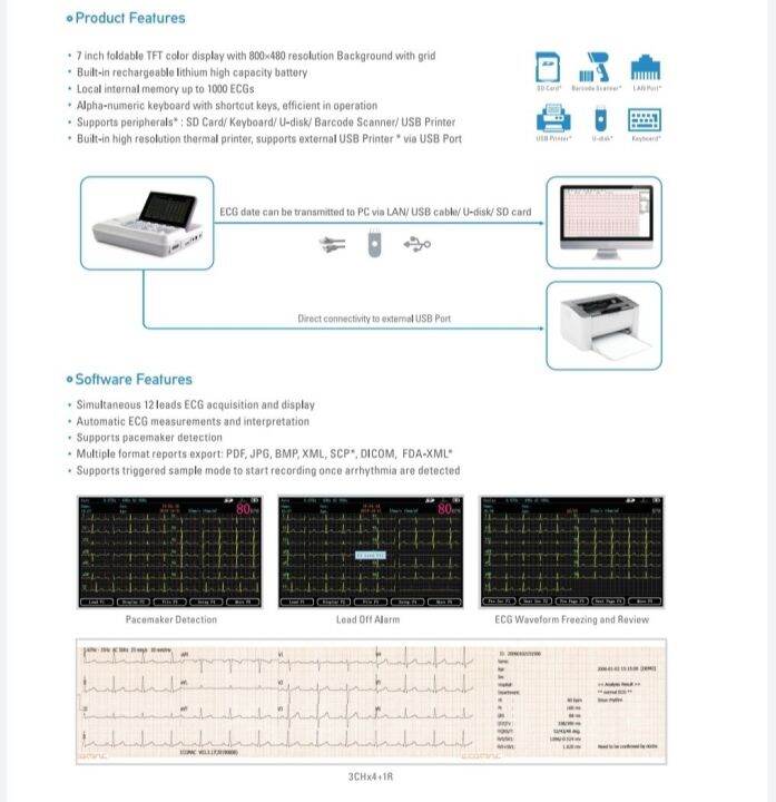 3 channel ECG Machine Description 3 Channel Resting ECG Machine ...