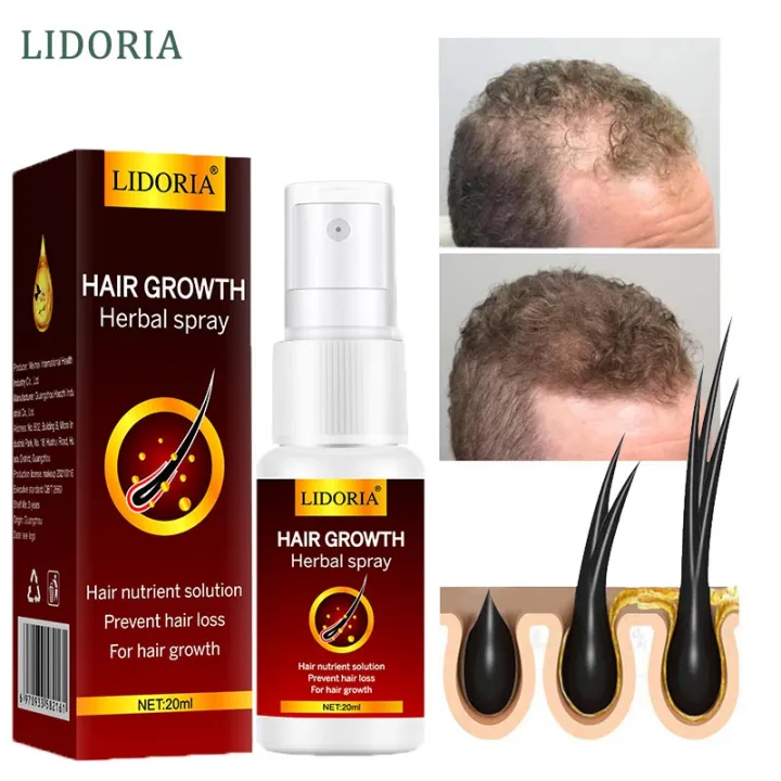 DeMoce Polygonum Ginger Hair Regrowth Spray Essence Hair Root ...
