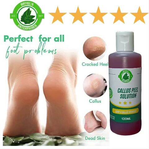 BRYELS'S CARE 60ML CALLUS REMOVER SOLUTION WITH CALLUS PILE 1 SET(KALYO REMOVER/KALYO PEEL ...