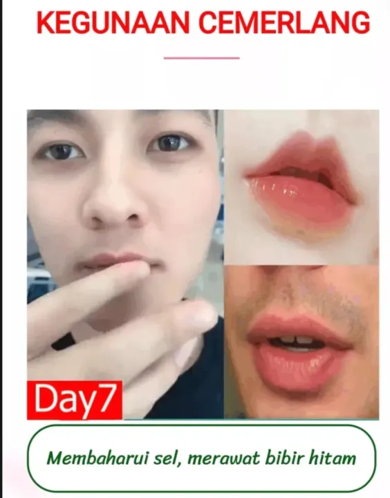 MERAWAT DAN MENCERAHKAN BIBIR YANG HITAM.. BIBIR HITAM WEI.. MALLUU.. RAWAT DENGAN VITAMIN C ...