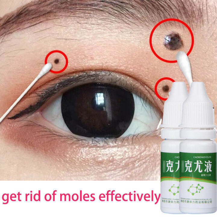 Wart Removal Liquid 10MLOrganic Authentic Warts Remover, Skin Tags ...