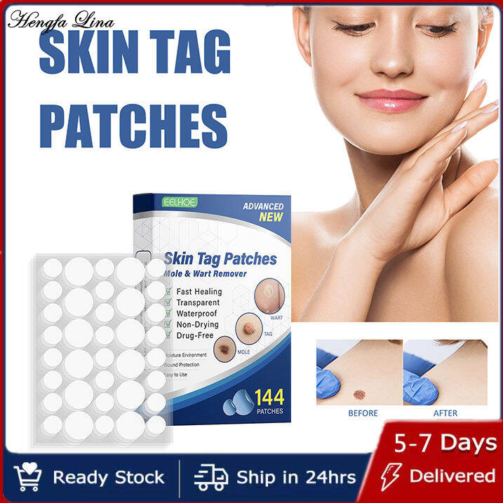 Hengfa Lina Wart Remover Wart Treatment Patches Antibacterial paste ...