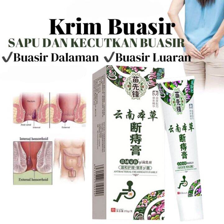 Skinvise Hemorrhoids Ointment Chinese Herbal Hemorrhoids Antibacterial