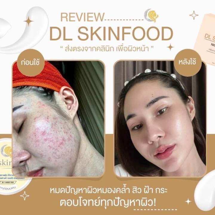 Deli Skin Night Cream Authentic from Thailand Acne Marks, Skin ...