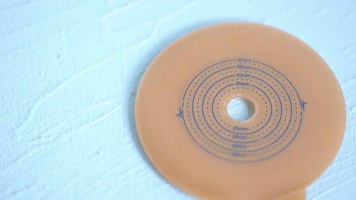 Two piece pocket stoma chassis fistula bag anal bag fecal bag rectal ...