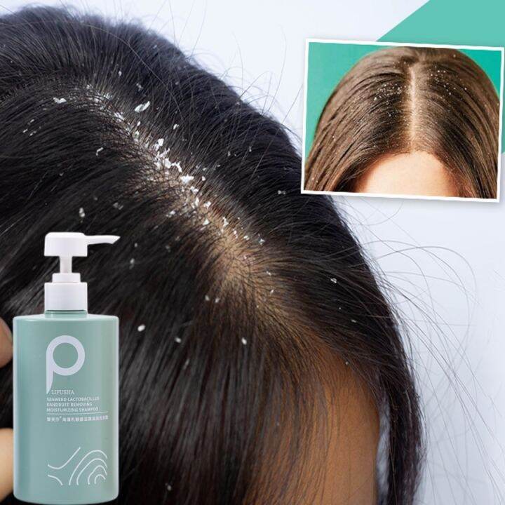 shampoo kelemumur Anti Dandruff Shampoo scalp itching treatment ...