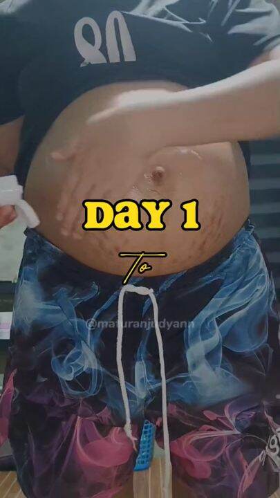 Original Anti-Stretch Mark Cream Cellulite Remover Anti Scar Cream For ...