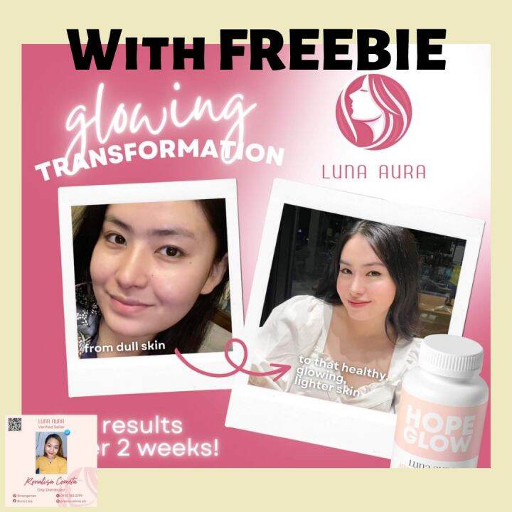 Hope Glow & Hope Beauty by Luna Aura | Lazada PH