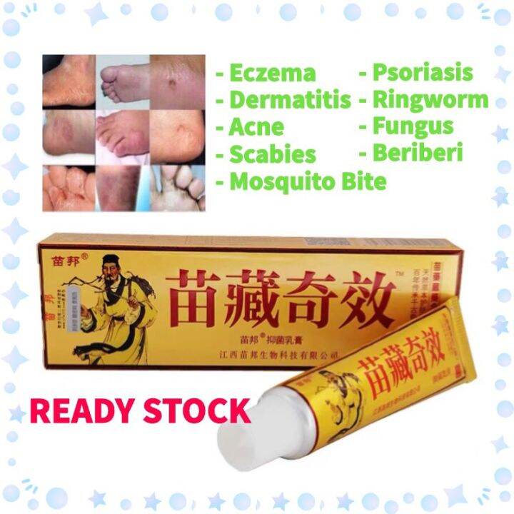 SMILING- Eczema Psoriasis Beriberi Fungus 100% Chinese Herbal Cream ...