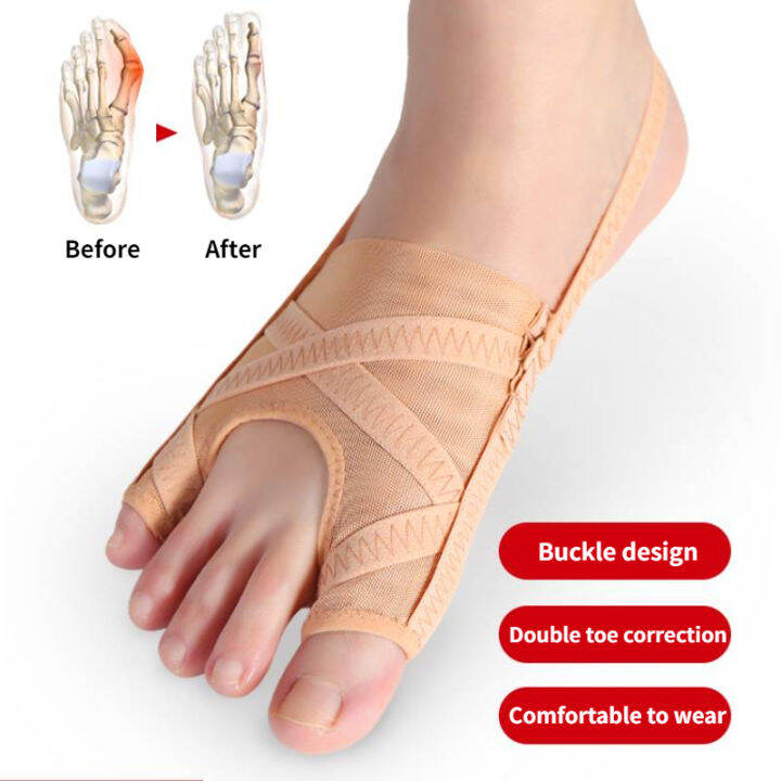 Thumb eversion little toe varus toe orthosis toe separation orthosis ...