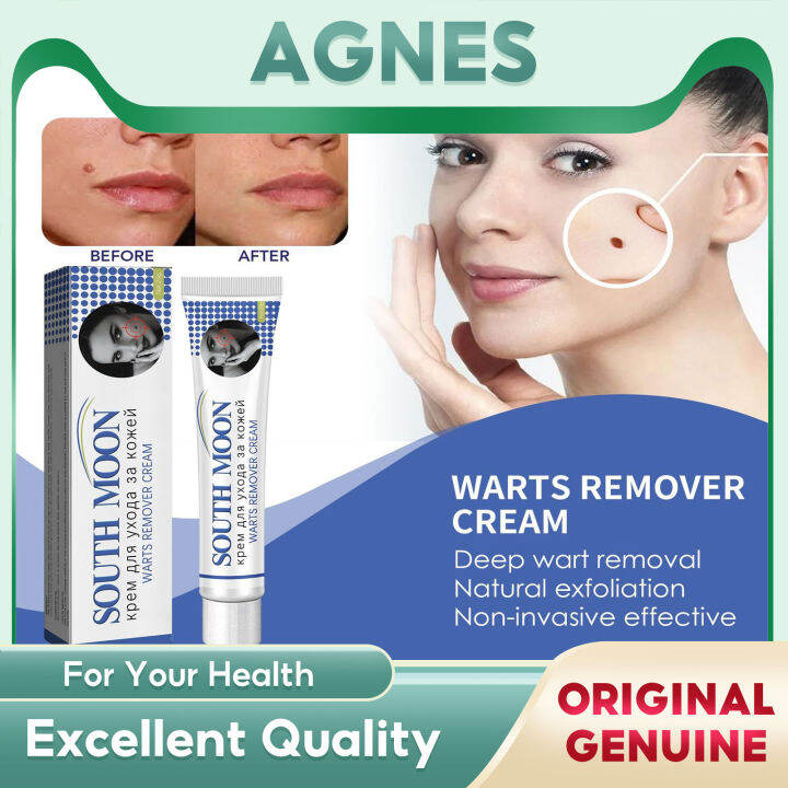 South Moon Wart Removal Cream Skin Tag Remover Warts Ointment Skin Tag ...