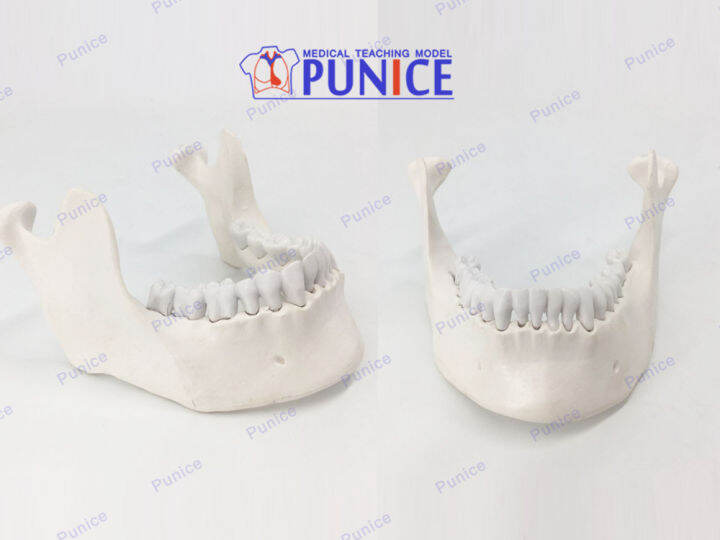 Dental Model Model for Dental Implant Simulation Model for Loose Bone ...