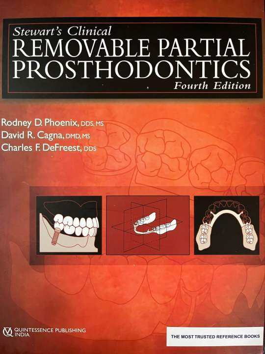 Stewart’s Clinical Removable Partial Prosthodontics-4th Edition | Lazada