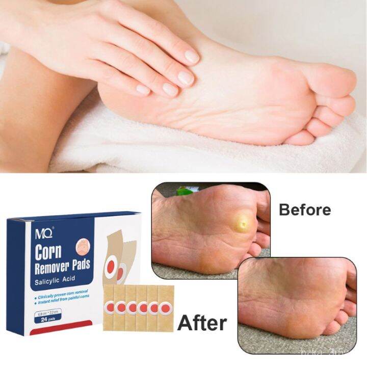 Feet Corns/ Warts Removal Patch warts removal patches Pain Relief ...