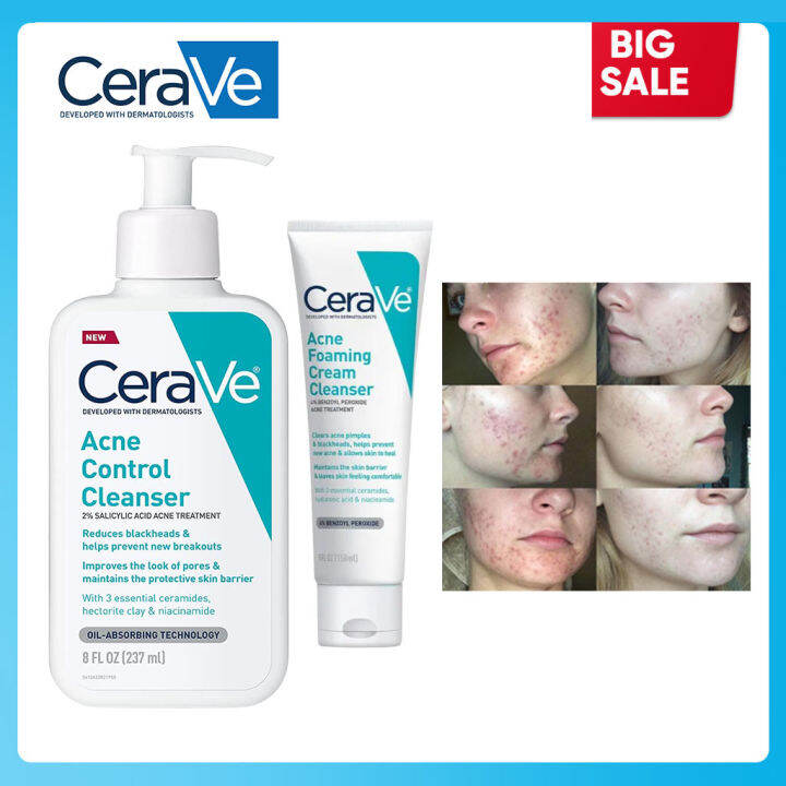 CeraVe Acne Control Cleanser 237ml/CeraVe Acne Foaming Cream Cleanser ...