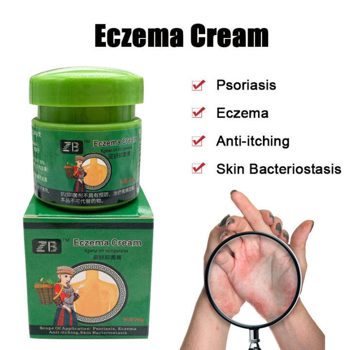 Zb Original Miaojia Herbal Eczema Cream Anti Itching Eczema Psoriasis