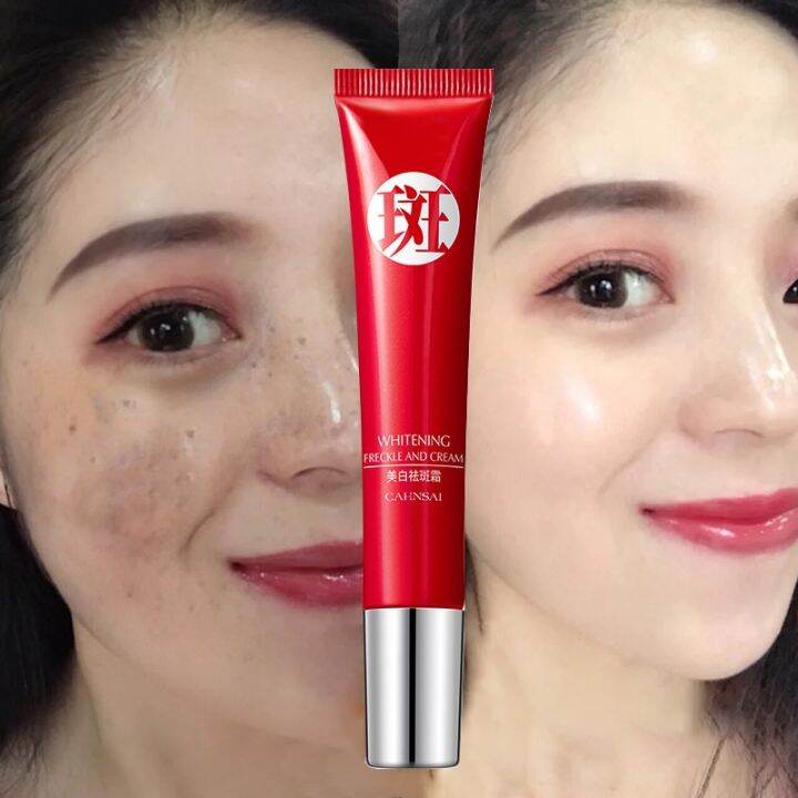 Original Strong Anti Freckle Whitening Cream Powerful Removing Age Dark ...