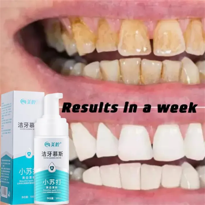 original Quickly whiten teeth mousse toothpaste Teeth Whitening Mousse ...
