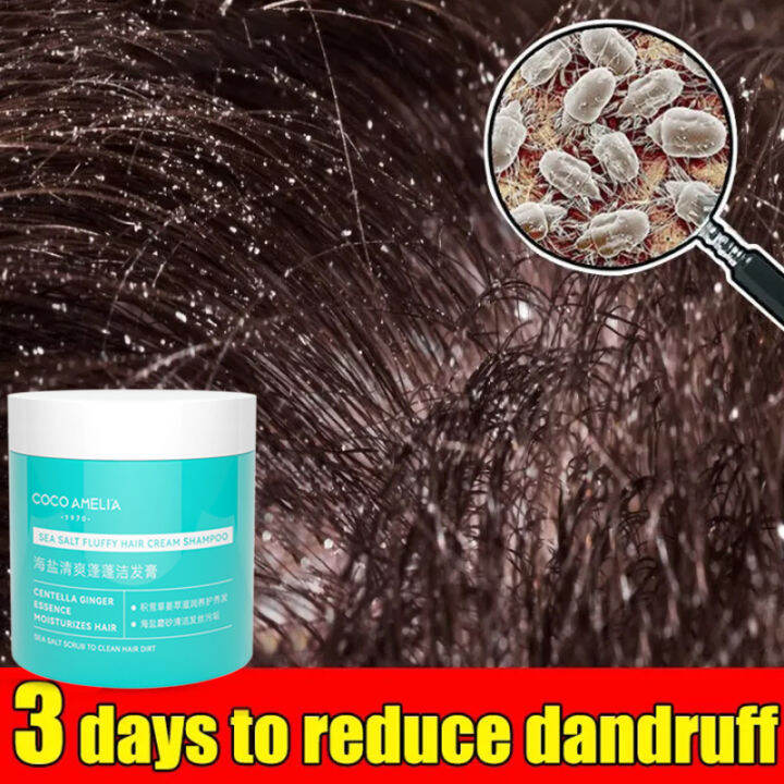 Sea Salt Shampoo Anti-Dandruff Refreshing Oil Control Deep Scalp ...