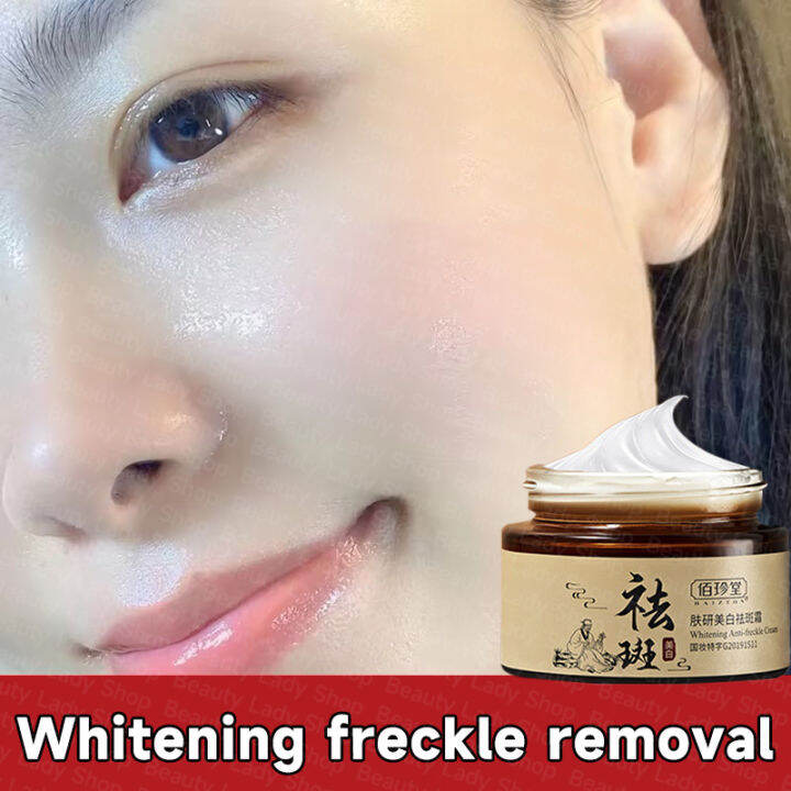 Whitening Freckle Removing Cream Whitening melasma cream original pekas ...