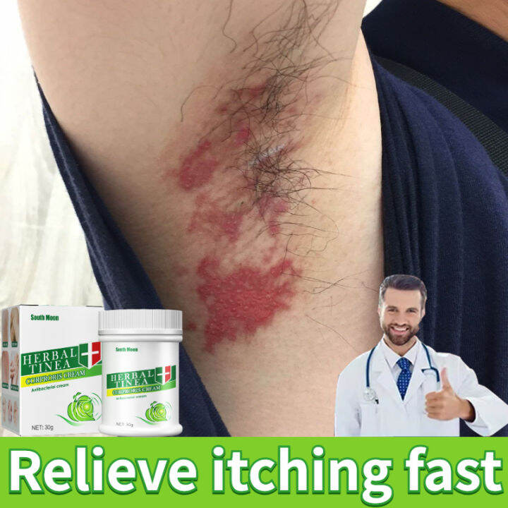 Antibacterial cream Eczema treatment cream Herbal Cream Psoriasis ...