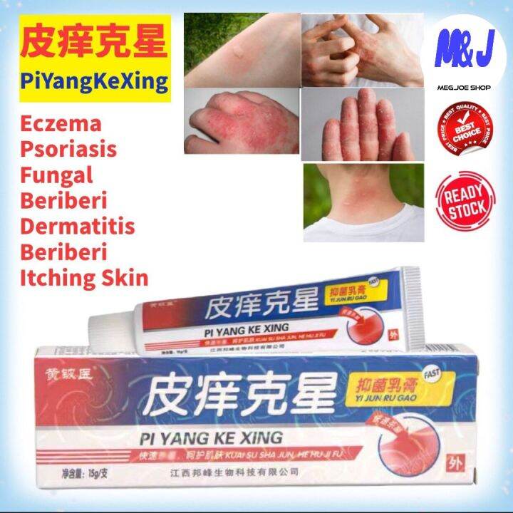 Eczema Fungus Antibacterial Antiseptic Ringworm Psoriasis Itchy Skin ...