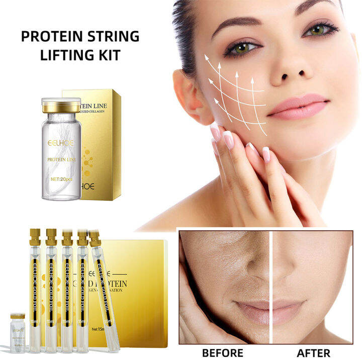 5 Bottle Protein String Lifting Kit Soluble Thread Nano Gold Essence ...