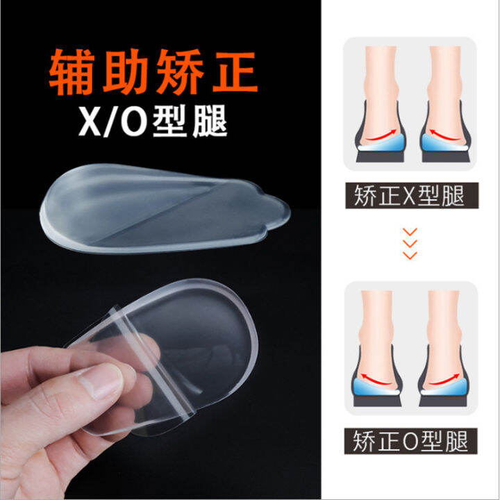 O-Leg Correction Insole Eight-Word Leg Type X-Shaped Leg Ring Leg ...